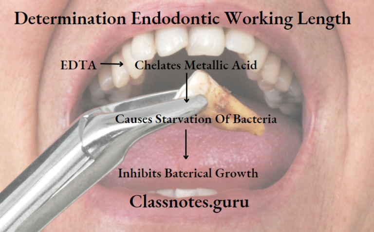 Determination Endodontic Working Length - Class Notes