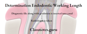 Determination Endodontic Working Length - Class Notes