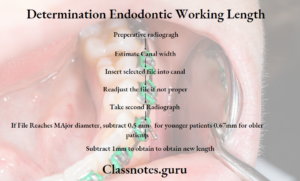 Determination Endodontic Working Length - Class Notes