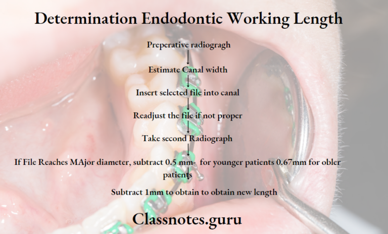 Determination Endodontic Working Length - Class Notes