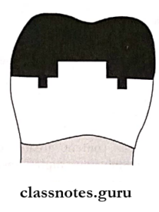 Dental Amalgam Question And Answers - Class Notes