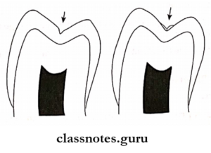 Dental Amalgam Question And Answers - Class Notes