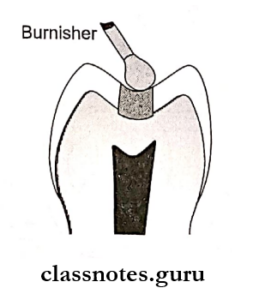 Dental Amalgam Question And Answers - Class Notes