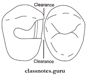 Dental Amalgam Question And Answers - Class Notes