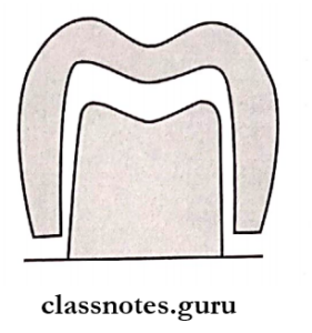 Cavity Preparation For Cast Metal Restorations Question And Answers ...