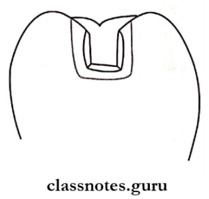 Cavity Preparation For Cast Metal Restorations Question And Answers ...