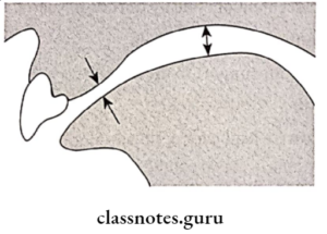 Denture Insertion - Class Notes