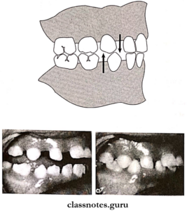 Development Of Dentition Question And Answers - Class Notes