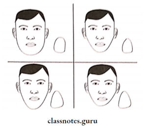 Diagnosis And Treatment Planning In Complete Denture - Class Notes