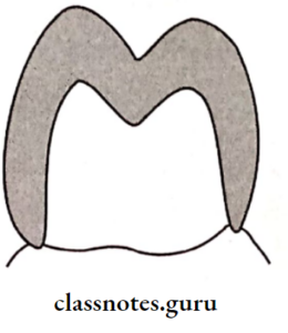 Fixed Partial Denture - Class Notes