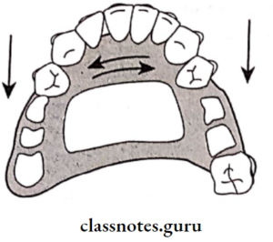 Fixed Partial Denture - Class Notes