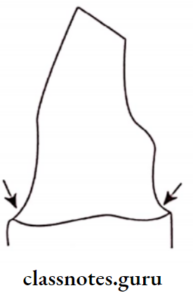 Fixed Partial Denture - Class Notes