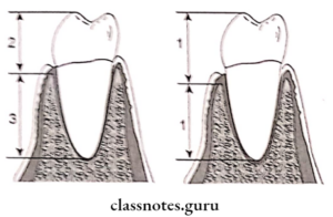 Fixed Partial Denture - Class Notes