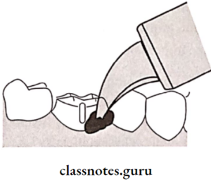 Fixed Partial Denture - Class Notes