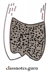Fixed Partial Denture - Class Notes