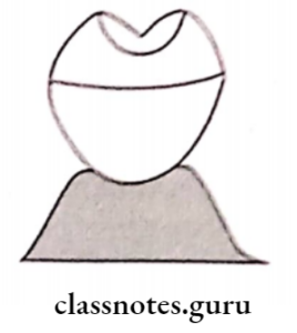 Fixed Partial Denture - Class Notes