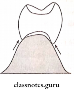 Fixed Partial Denture - Class Notes