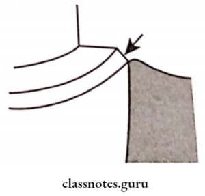 Prosthodontics Archives - Class Notes