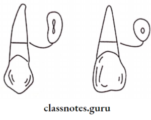 Fixed Partial Denture - Class Notes