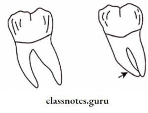 Fixed Partial Denture - Class Notes