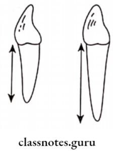 Fixed Partial Denture - Class Notes