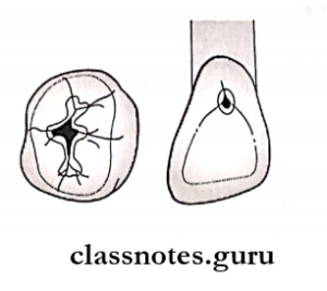 Fundamentals Of Cavity Preparation Question And Answers - Class Notes