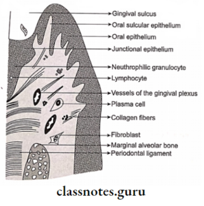 Gingival Inflammation - Class Notes