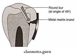 Glass-ionomer Cements In Restorative Dentistry Question And Answers ...