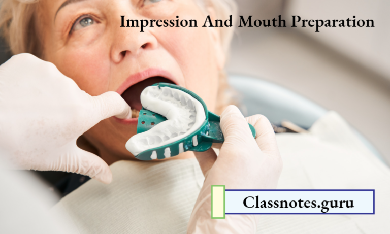 Impression And Mouth Preparation - Class Notes