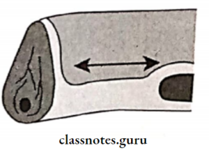 Impression And Mouth Preparation - Class Notes