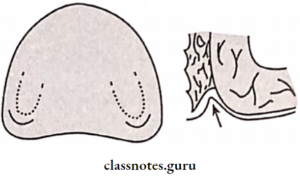 Impression And Mouth Preparation - Class Notes