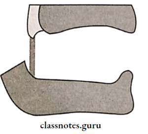 Impression And Mouth Preparation - Class Notes