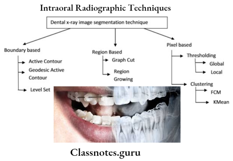 Intraoral Radiographic Techniques Short Essays - Class Notes