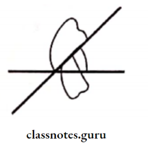 Maxillomandibular Relations Long Essays - Class Notes