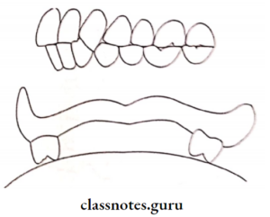 Maxillomandibular Relations Short Essays - Class Notes