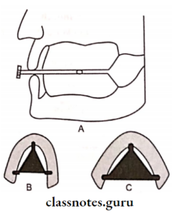 Maxillomandibular Relations Long Essays - Class Notes