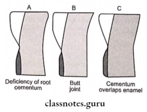 Normal Periodontium Short Question and Answers - Class Notes