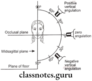 Intraoral Radiographic Techniques Long Essays - Class Notes