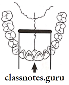 Intraoral Radiographic Techniques Long Essays - Class Notes