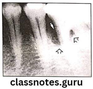 Radiographic Interpretations Question And Answers - Class Notes
