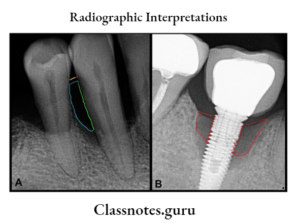 Radiographic Interpretations Question And Answers - Class Notes