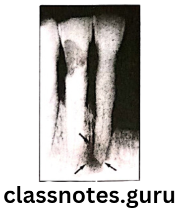 Radiographic Interpretations Question And Answers - Class Notes