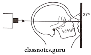 Specialized Radiographic Techniques Short Essays - Class Notes