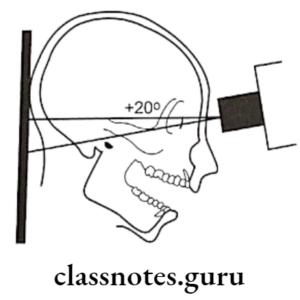 Specialized Radiographic Techniques Long Essays - Class Notes