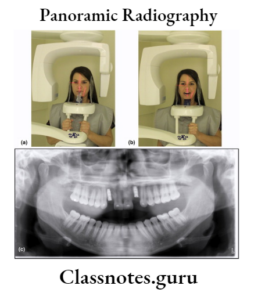 Panoramic Radiography Question And Answers - Class Notes