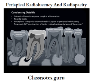 Periapical Radiolucency And Radiopacity Question And Answers - Class Notes