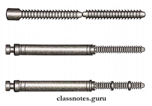 Pin Retained Restoration Question And Answers - Class Notes
