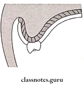 Prosthodontics Archives - Class Notes