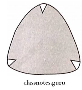 Relining And Rebasing Of Complete Dentures - Class Notes
