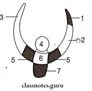 Removable Partial Dentures - Class Notes